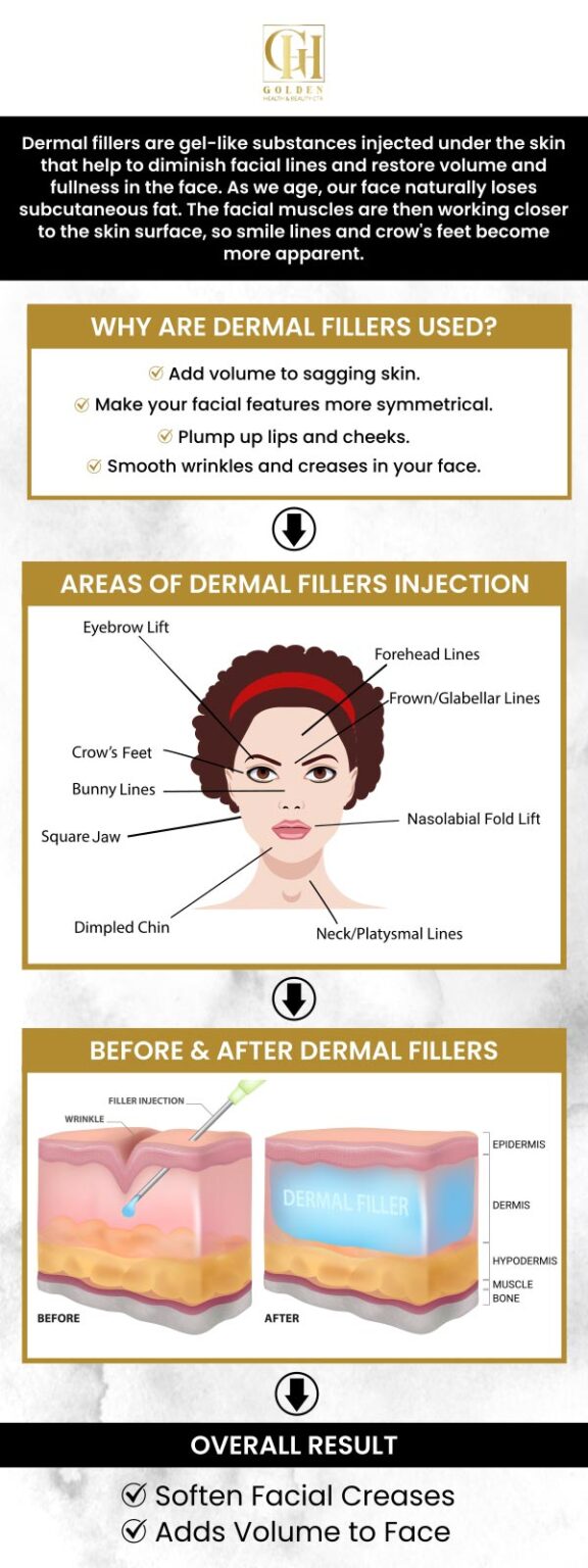 Cost of Dermal Fillers Near Me In Encino CA
